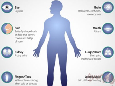 Diseases A-Z - Ayur Healthcare